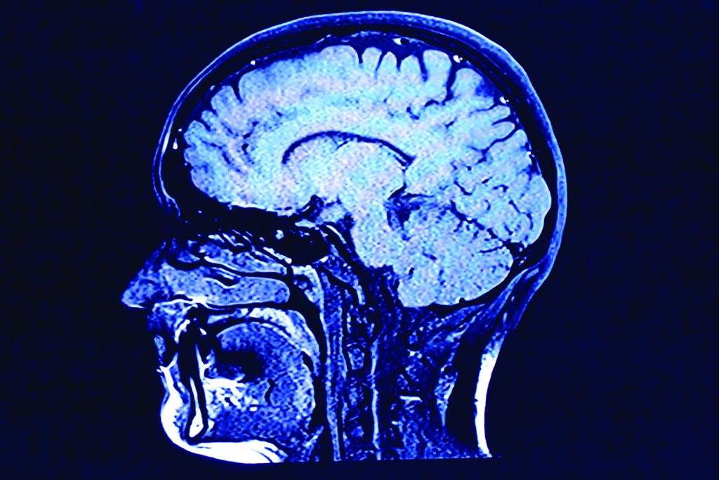 UPMC brings free concussion baseline testing to Washington - Herald ...